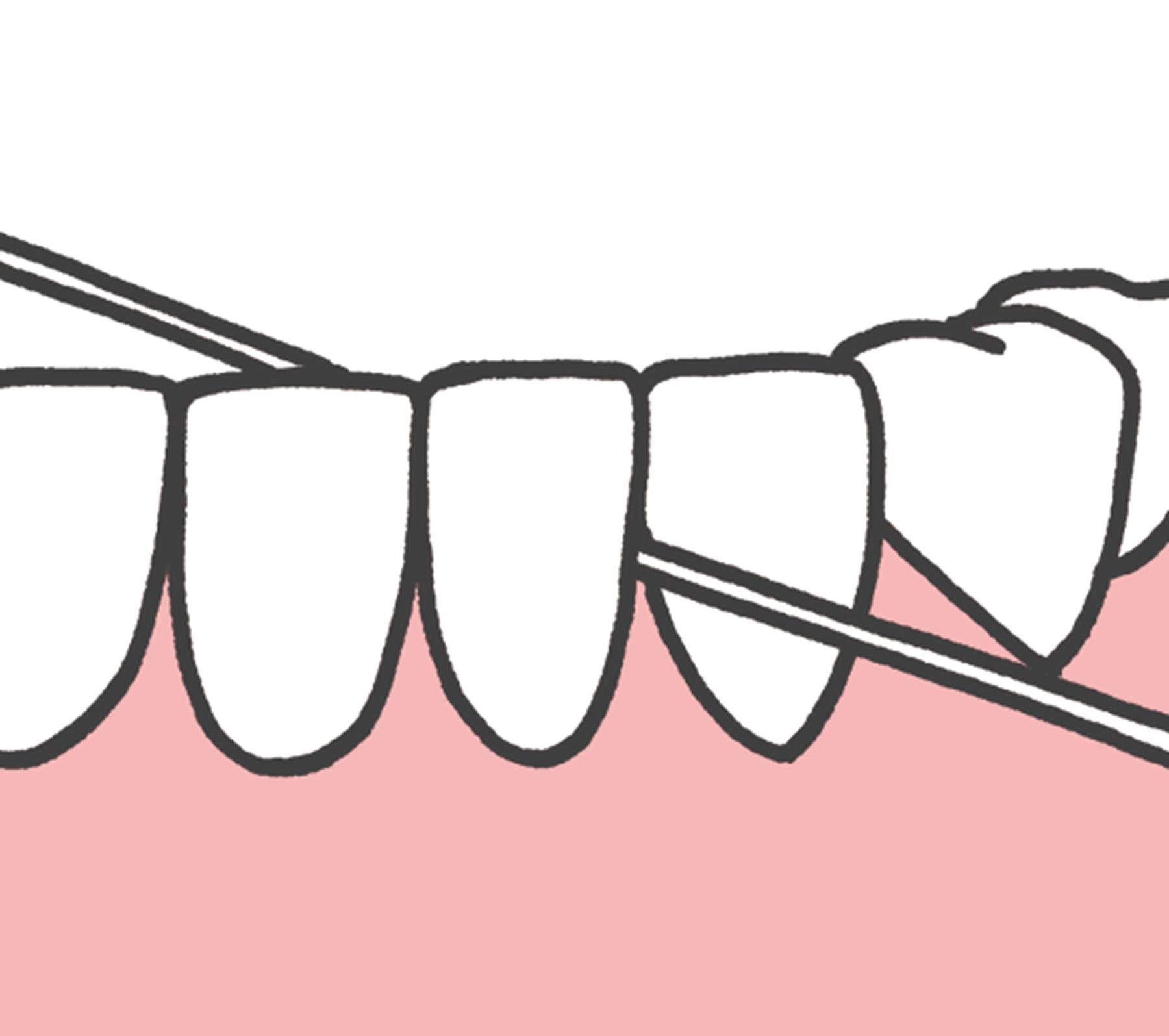 【オーラルケア】歯間と歯茎を意識したケアが口内環境を改善するカギに | ビューティー、ファッション、エンタメ、占い…最新情報を毎日更新 | ananweb